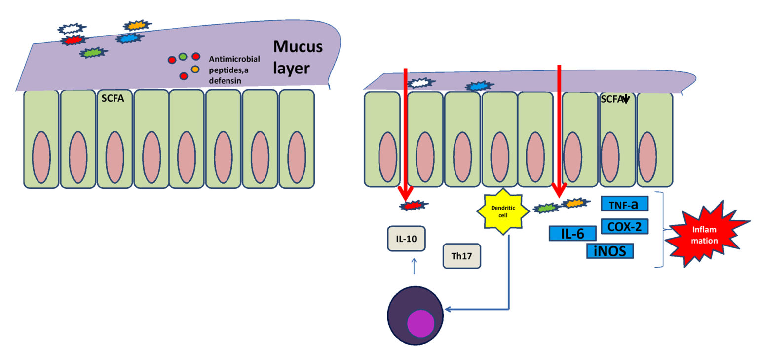 Gut Microbiota: A Future Clinical Magic Bullet to Manifest Pathogenic ...