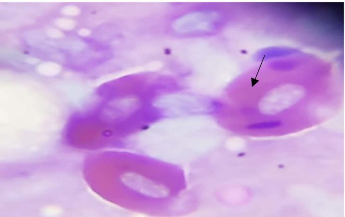 Detection of Blood Parasites in Fish - Journal of Pure and Applied ...