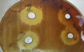 Antibacterial and Cytotoxic Activity of Mentha arvensis L. Leaves ...