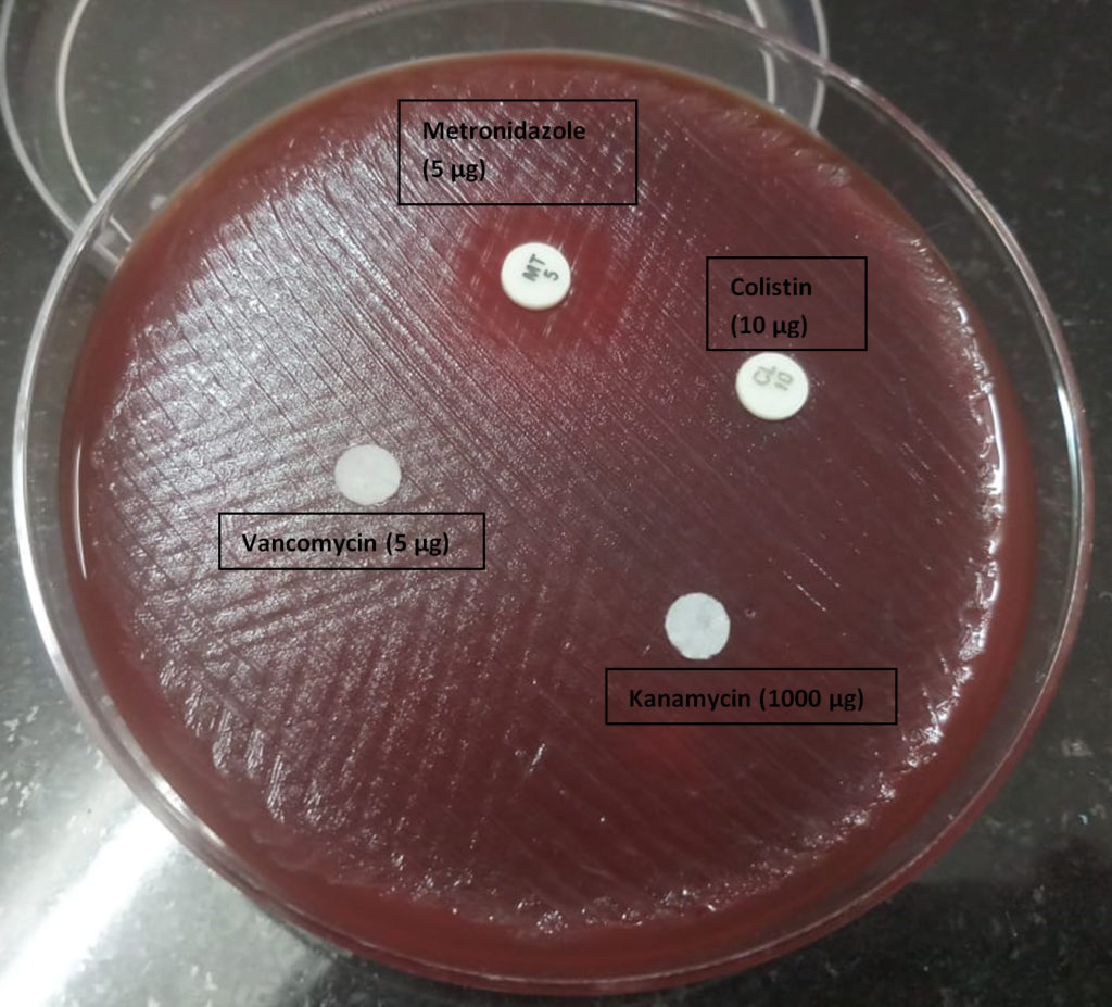 Anaerobic Profile of Intra-abdominal Infections – A 23-Year ...