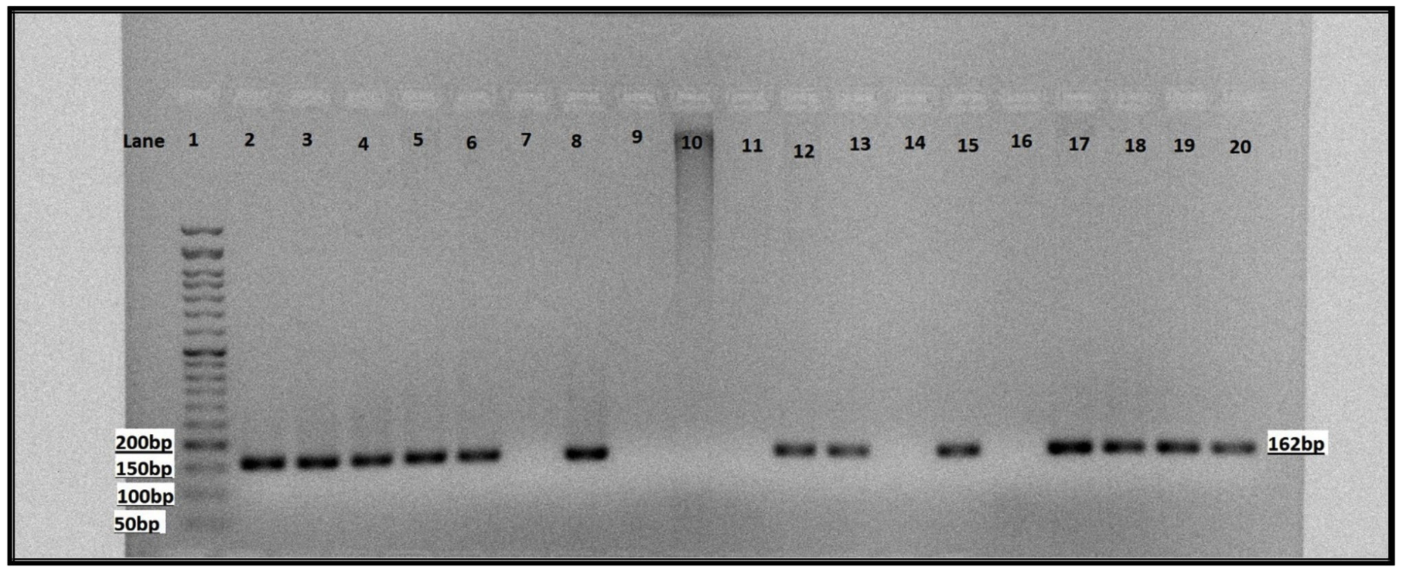 Role of Oxacillin Susceptibility Testing Strategy in Changing Scenario ...