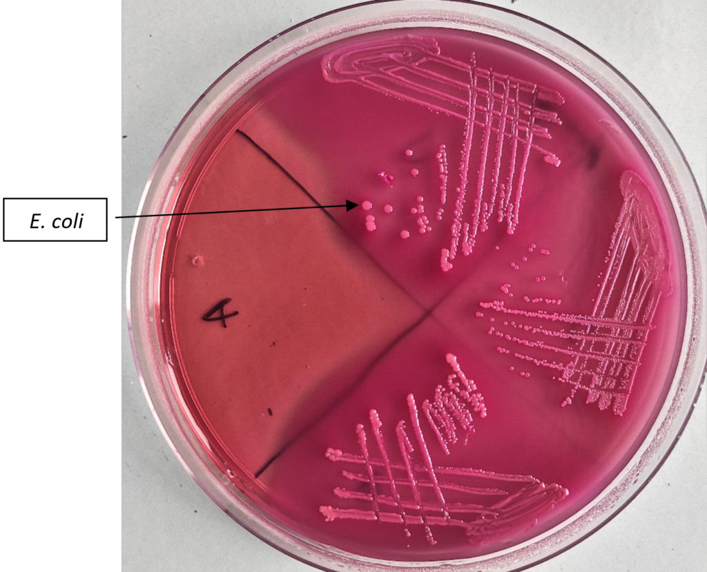 Genomic Determinants and Antimicrobial Resistance Pattern of Clinical ...