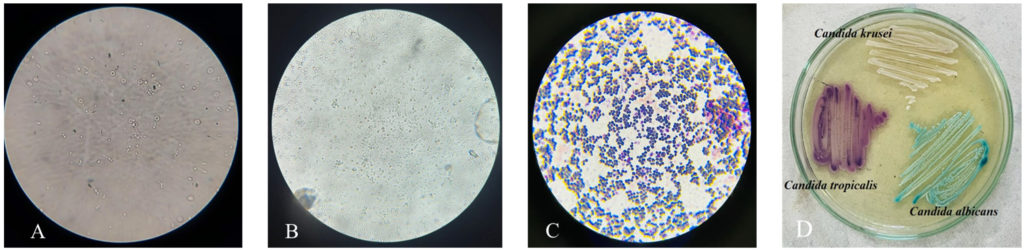 Characterization and Susceptibility Pattern of Candida Species from ...
