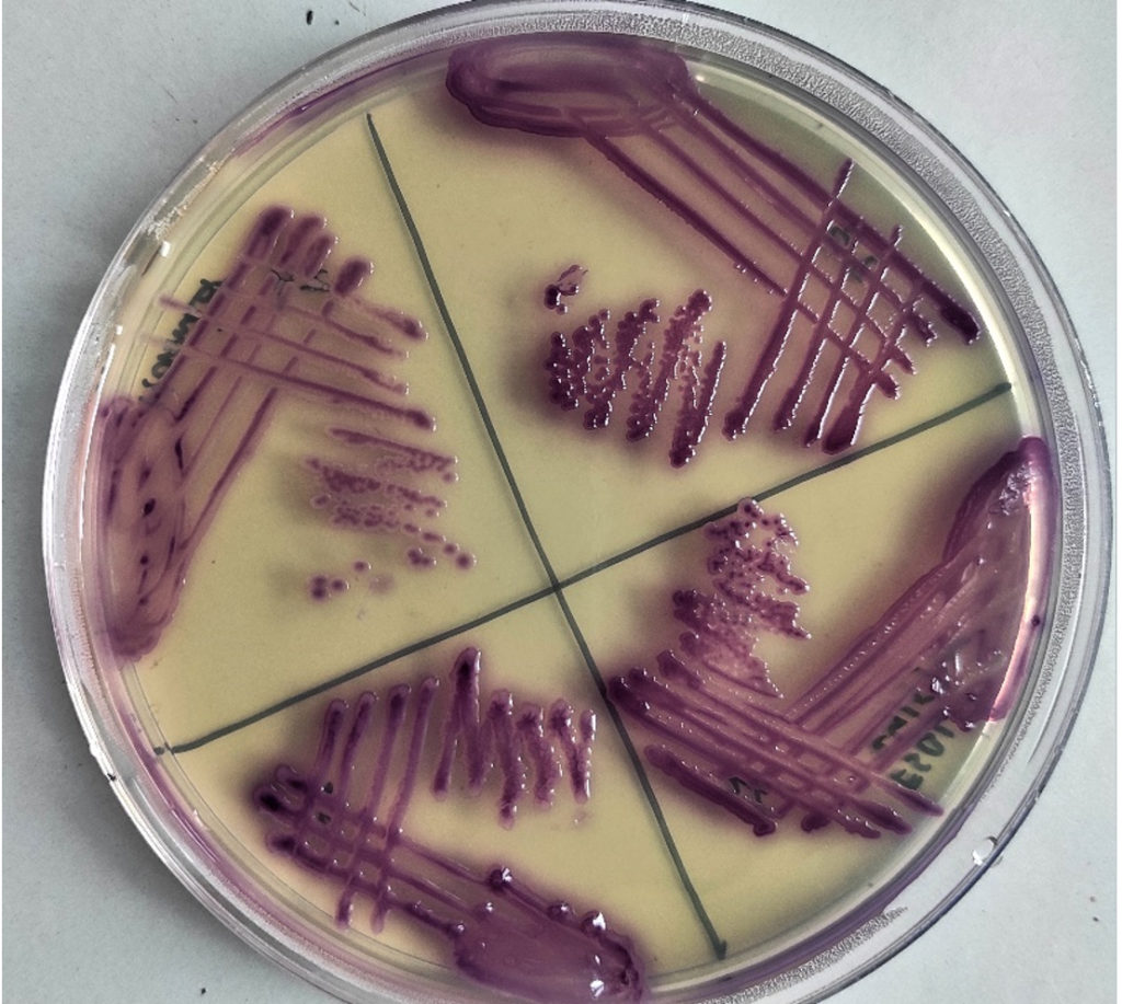 Genomic Determinants and Antimicrobial Resistance Pattern of Clinical ...