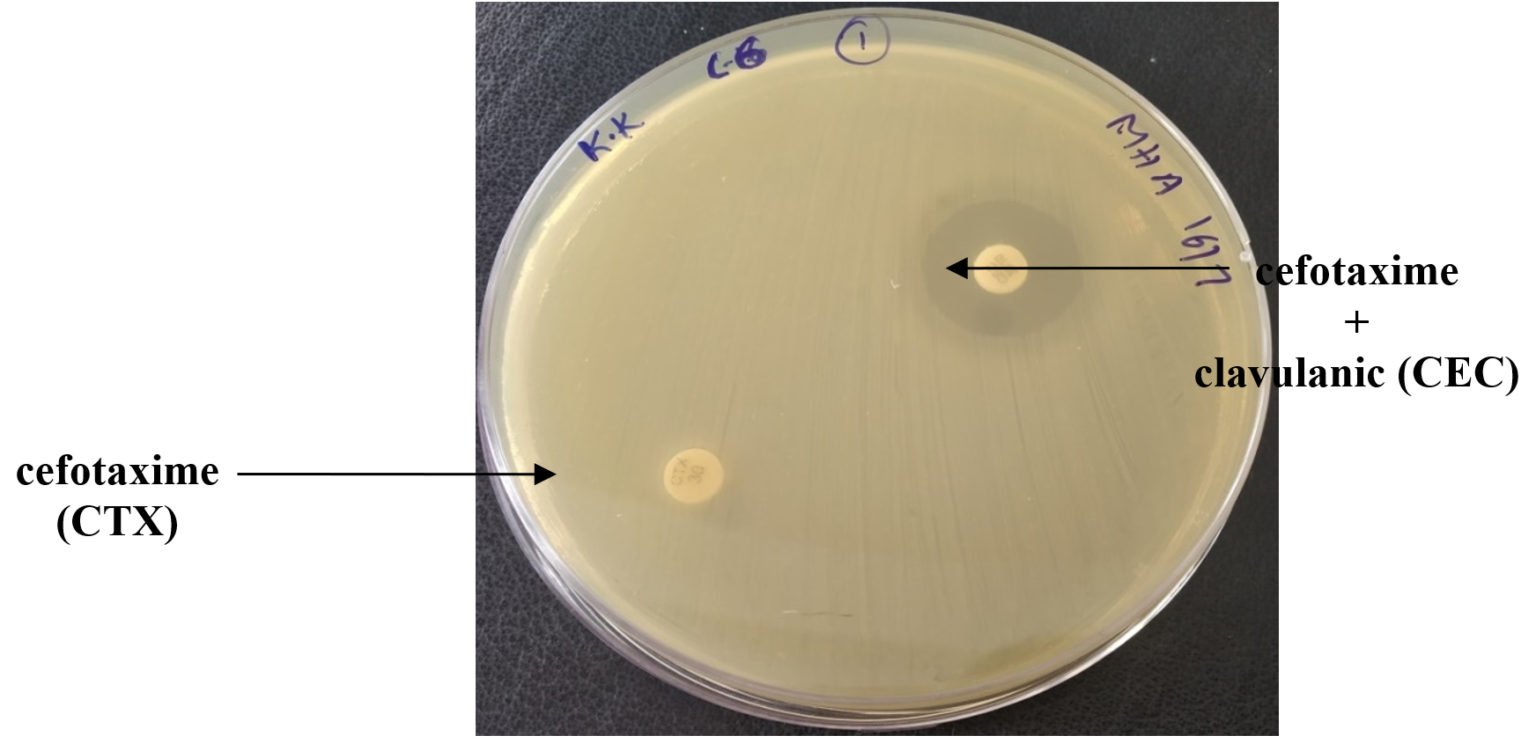 Genomic Determinants and Antimicrobial Resistance Pattern of Clinical ...