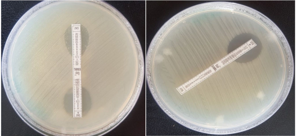 Genomic Determinants and Antimicrobial Resistance Pattern of Clinical ...