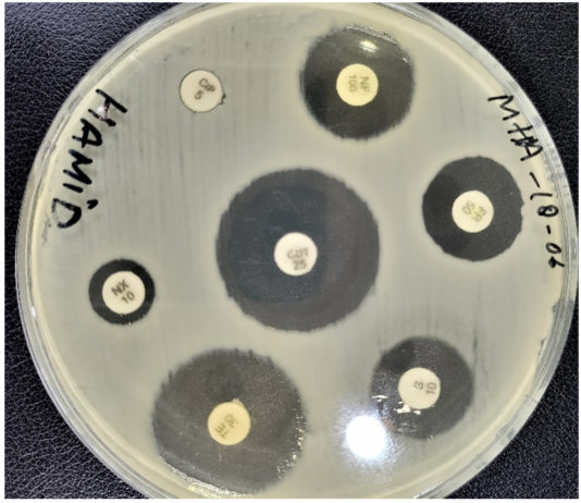 Genomic Determinants and Antimicrobial Resistance Pattern of Clinical ...