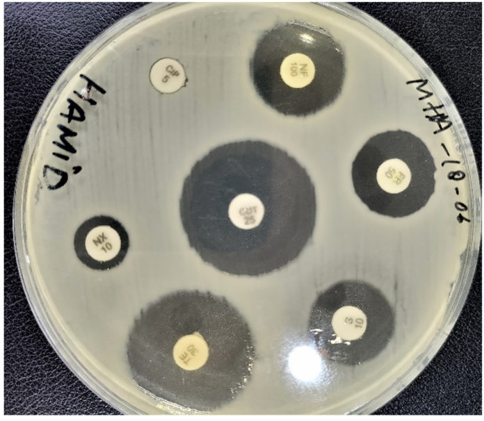Genomic Determinants and Antimicrobial Resistance Pattern of Clinical ...