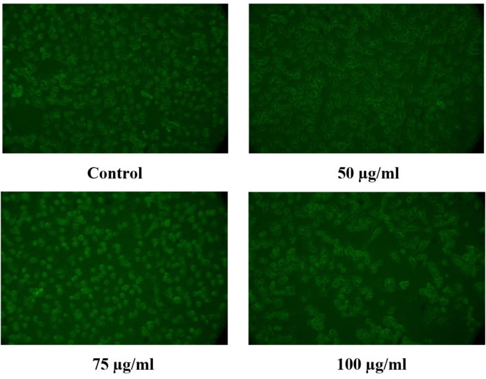 Evaluating the Antibacterial Profile of Copper Oxide Nanoparticles ...