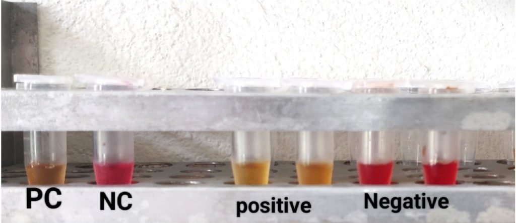 Phenotypic Detection of Carbapenemase Production in Gram Negative ...