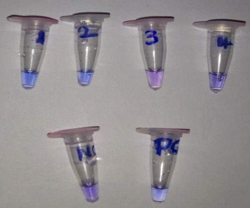 Application of Nested PCR and Loop-Mediated Isothermal Amplification ...