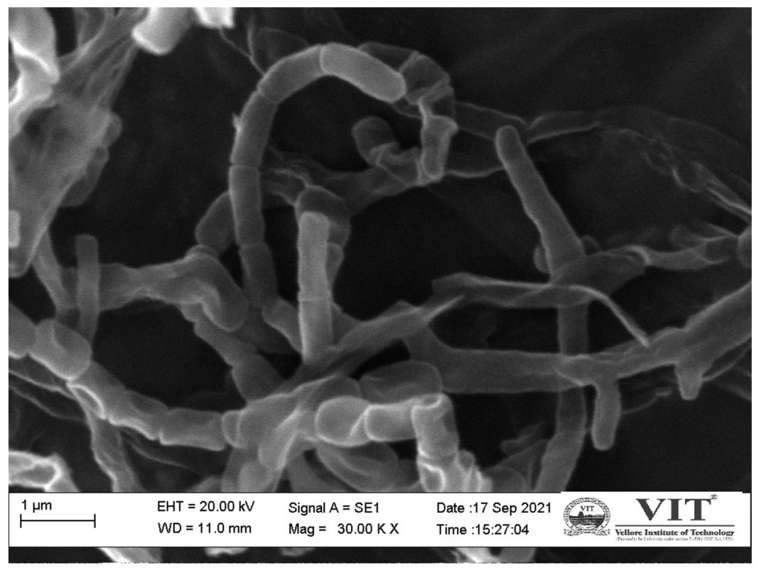 Antibacterial Activities of Secondary Metabolites Derived from ...