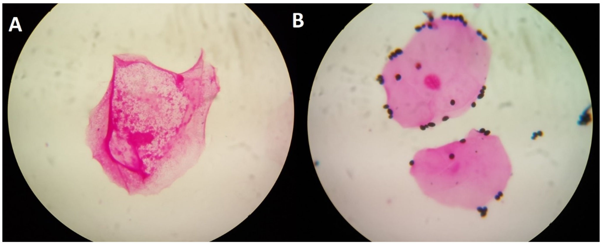 Adherence of Candida Species Isolated from Patients with Head and Neck ...
