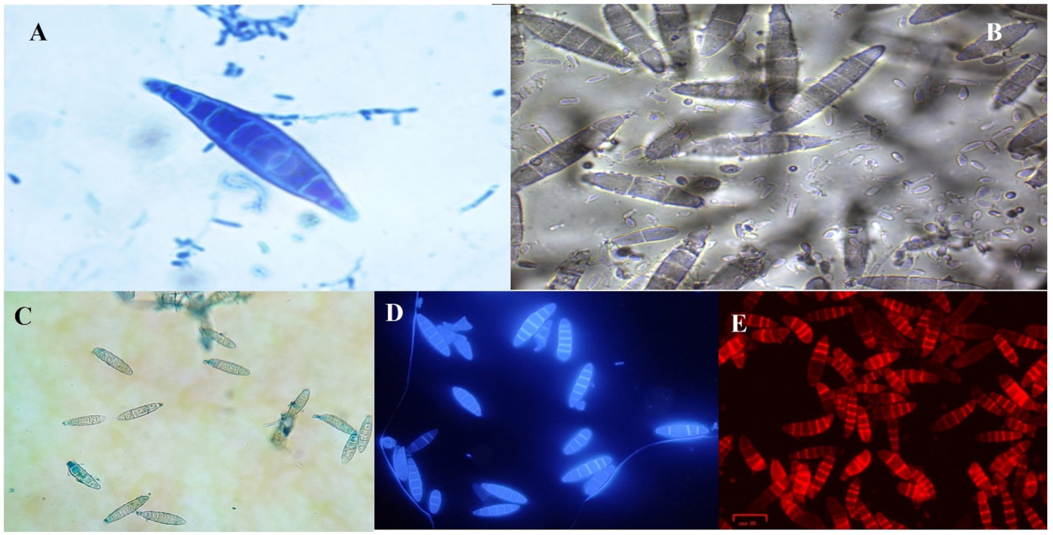Clinical and Mycological Characterization of Chronic and Recurrent ...