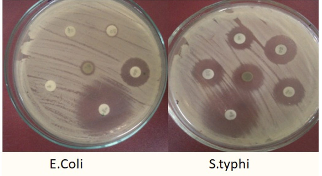 Microbial Profile and Antibiotic Susceptibility Pattern of Frozen Food ...