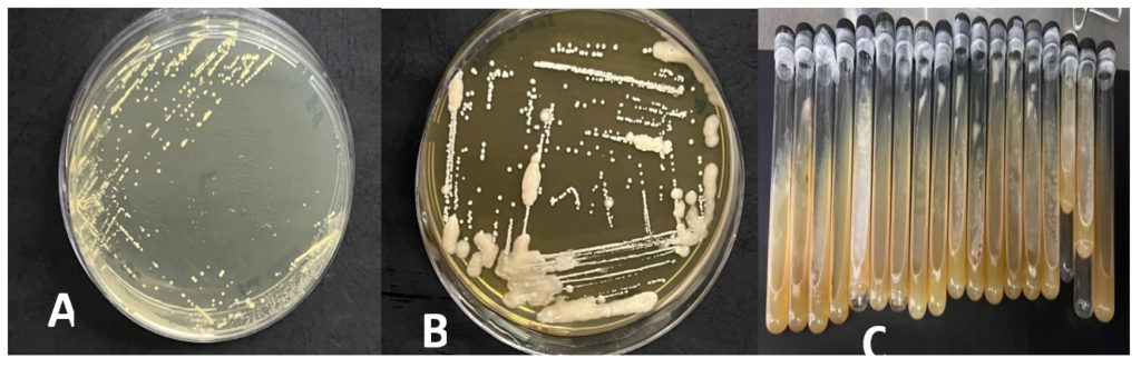 Identification of Cellulose Producing Bacterial Strains: An Eco ...