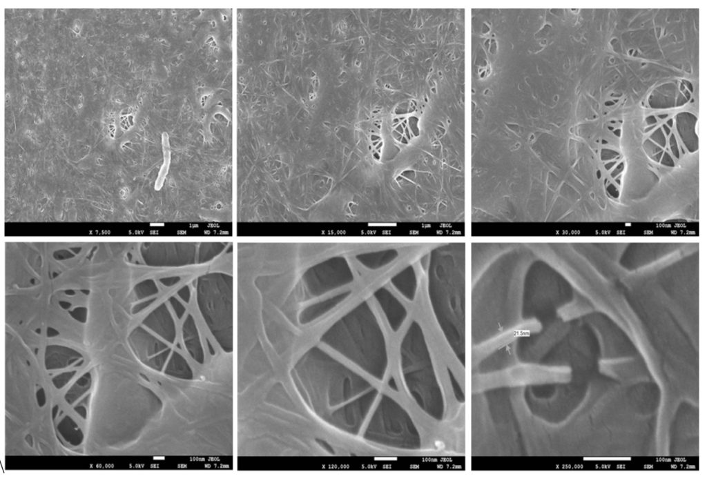 Identification of Cellulose Producing Bacterial Strains: An Eco ...