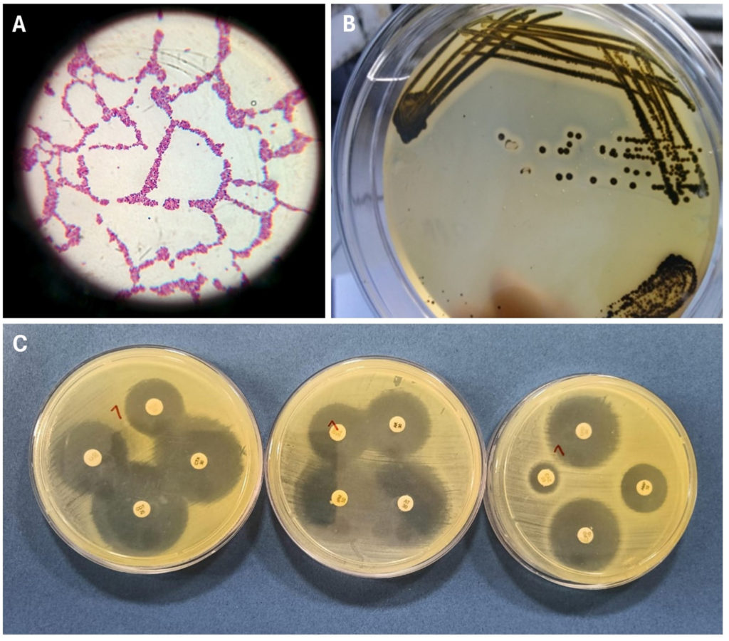 Isolation and Characterization of Bacterial Contaminants from Bone ...