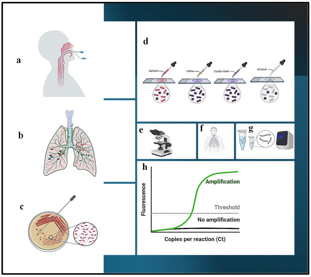 Pathogenesis, Diagnosis and Therapeutic Strategies for Ventilator ...