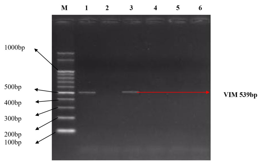 A Study of Genotypic Characterization of ESBL and MBL Genes of β ...