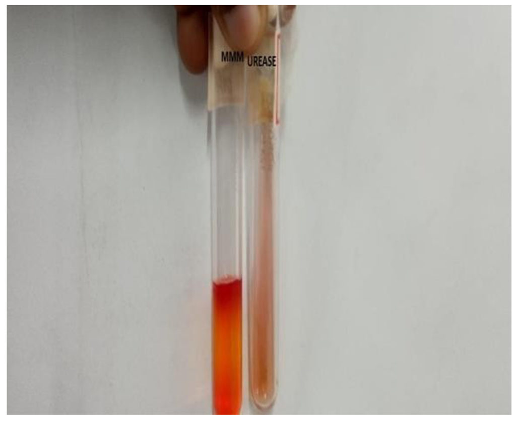 Antibacterial Activity of the Allium sativum Crude Extract against ...