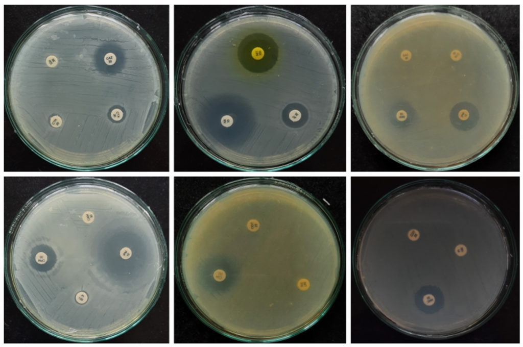 Incidence of Bacterial Uropathogens and their Antibiotic Susceptibility ...