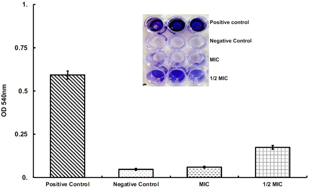 Lichenysin Produced by Bacillus licheniformis RG1002 Inhibit the ...