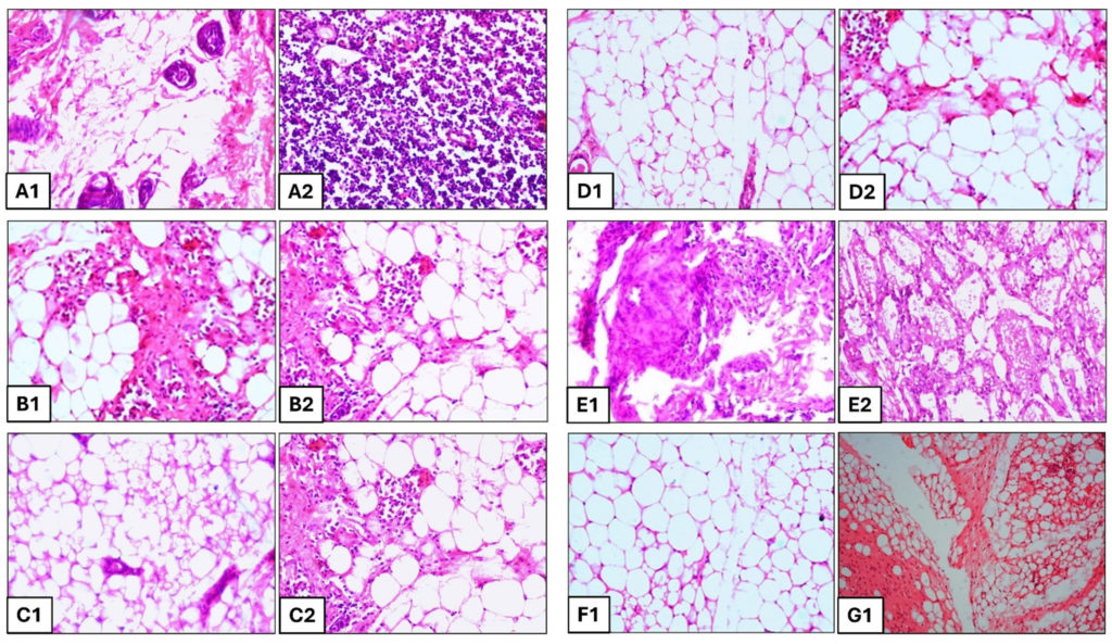 Therapeutic Efficacy of Baicalein Green Biomolecule in Methicillin ...