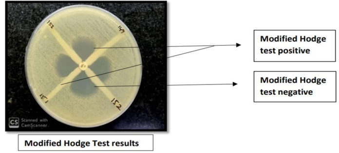 Burden of Multidrug-Resistant Gram-Negative Bacterial Infections in a ...