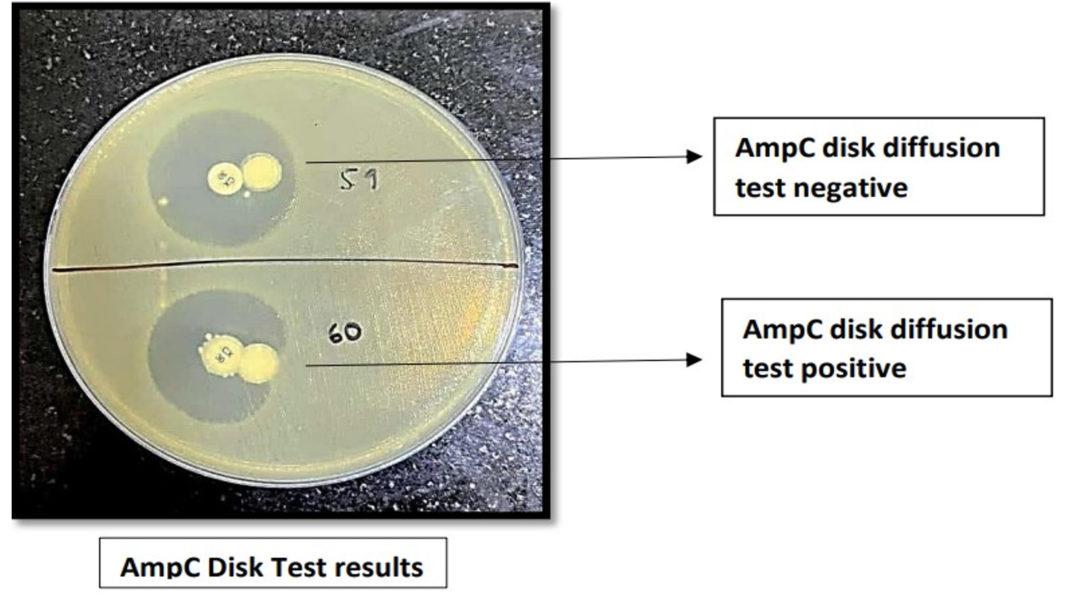 Burden of Multidrug-Resistant Gram-Negative Bacterial Infections in a ...