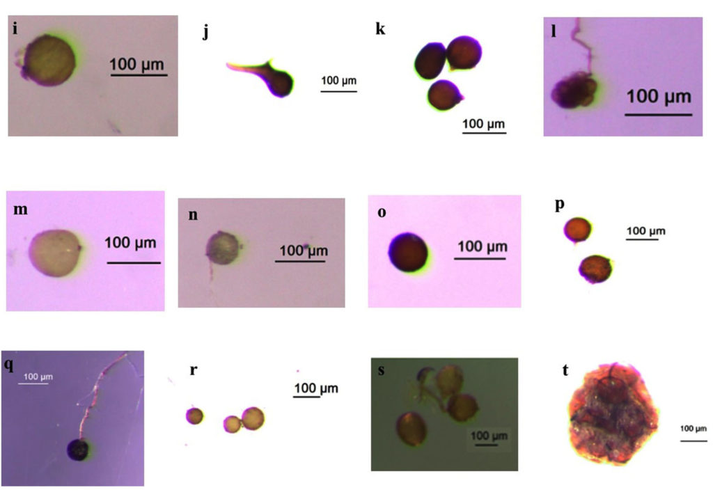 Arbuscular Mycorrhizal Fungi and Soil Enzyme Activities in Different ...