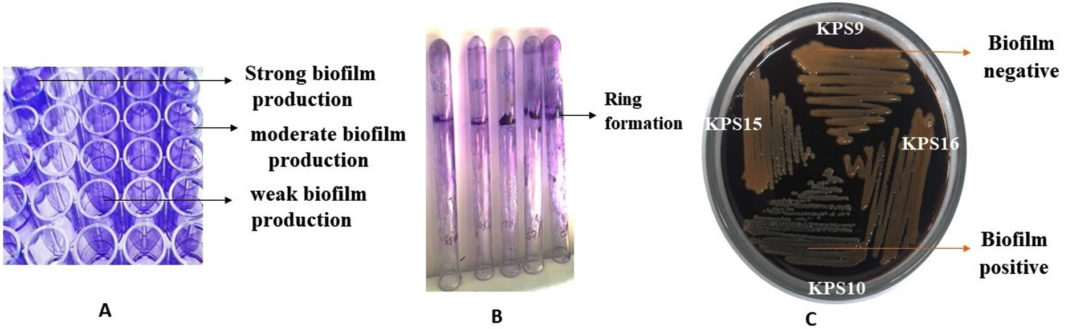Antimicrobial Resistance and Biofilm Formation in Klebsiella pneumoniae ...