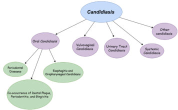 The Impact of Diabetes Mellitus on Fungal Infections: Pathophysiology ...