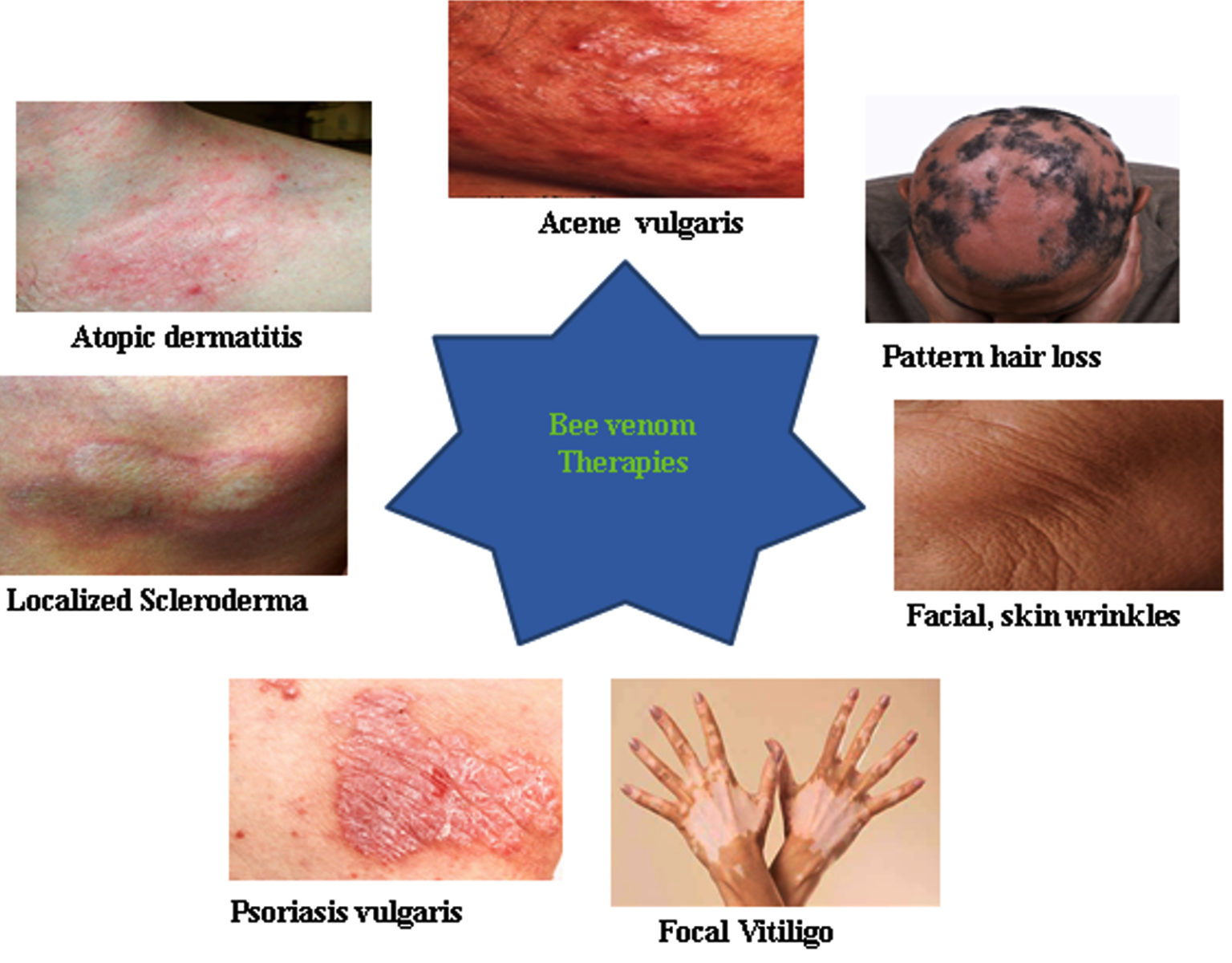 Biomedical Applications of Bee Venom: A Natural Approach to Cancer ...