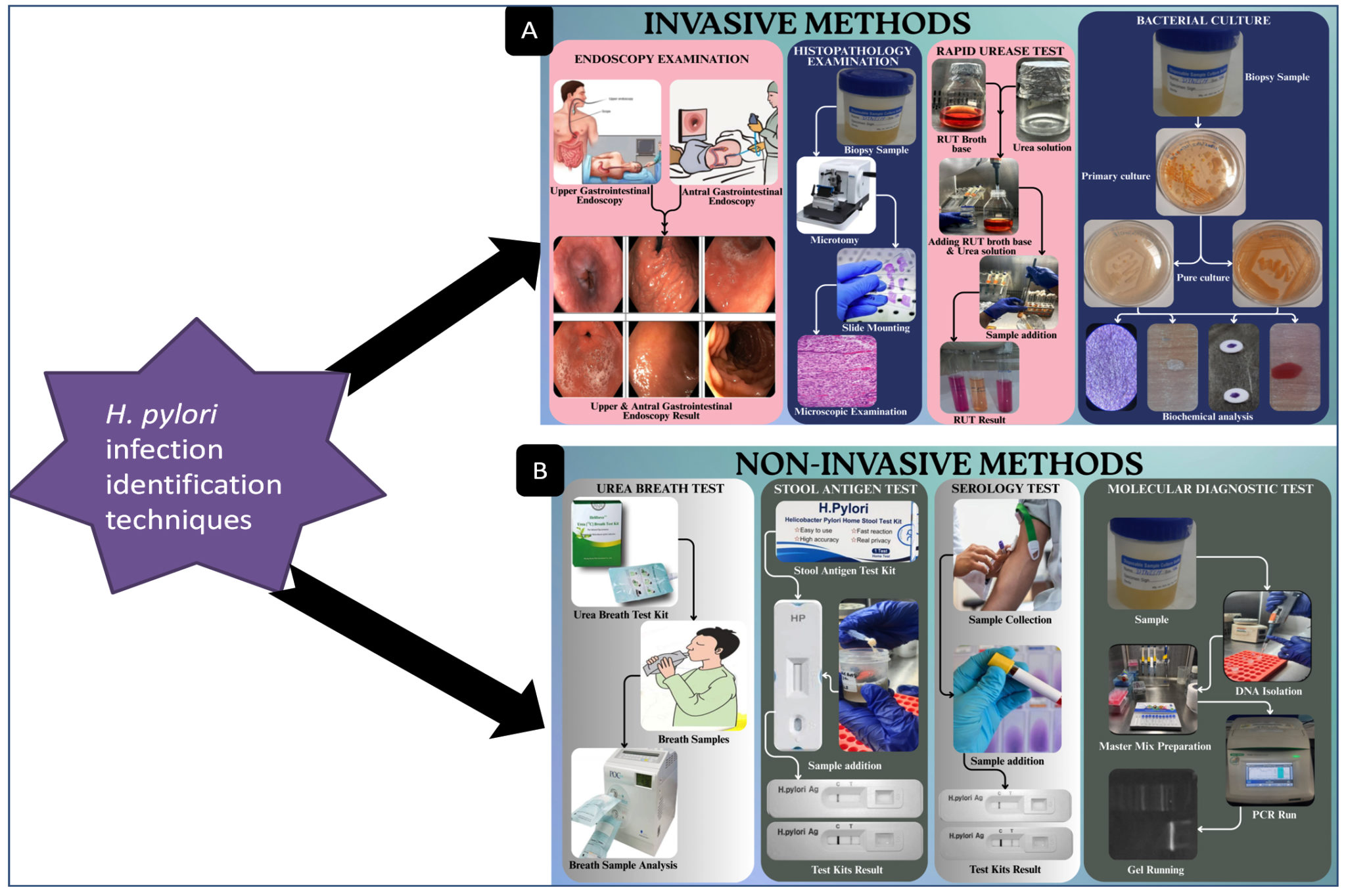 Molecular Mechanisms of Helicobacter pylori Infection: A Review ...