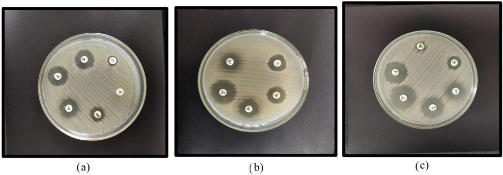 Prevalence of Extended Spectrum β-lactamase and AmpC β-lactamase among ...