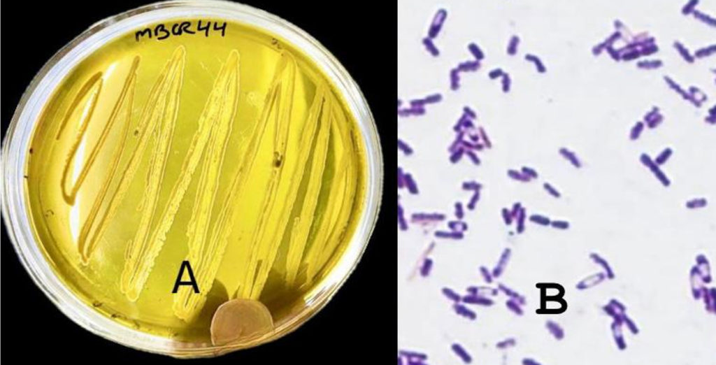 Chromium Tolerance and Removal Efficiency of Environmental Bacterial ...